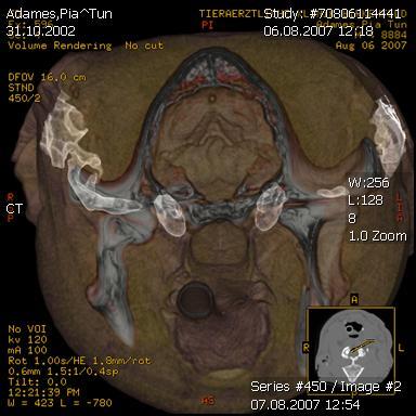 Computed tomography (Scanner) - Nuclear Magnetic Resonance (NMR)
