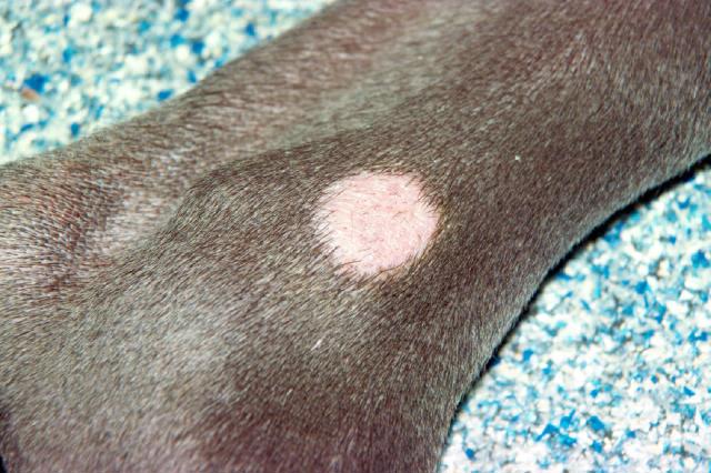 Dermatophytosis / Ringworm - Mycosis - fungal infections of the skin